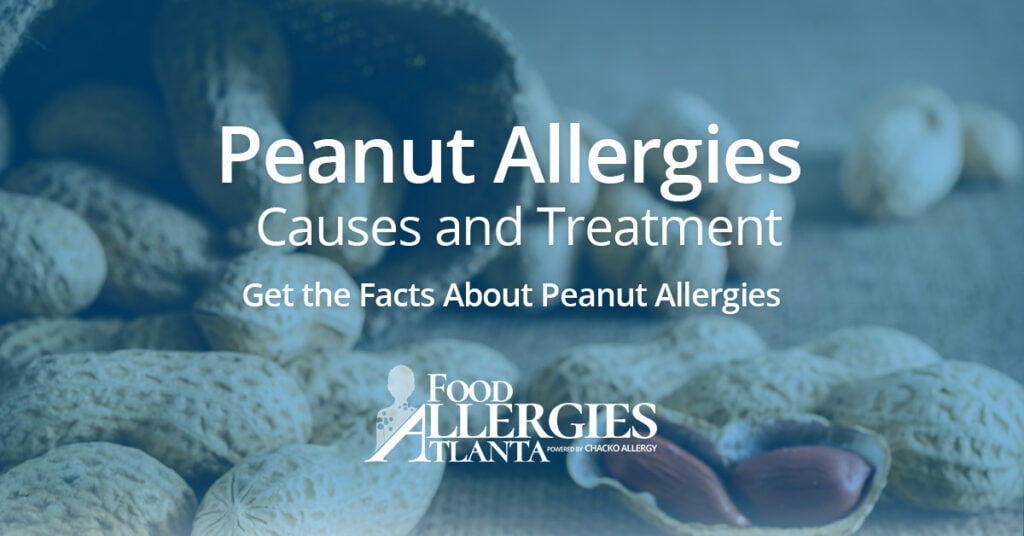 Get the Facts About Peanut Allergies – Infographic Included | Food ...